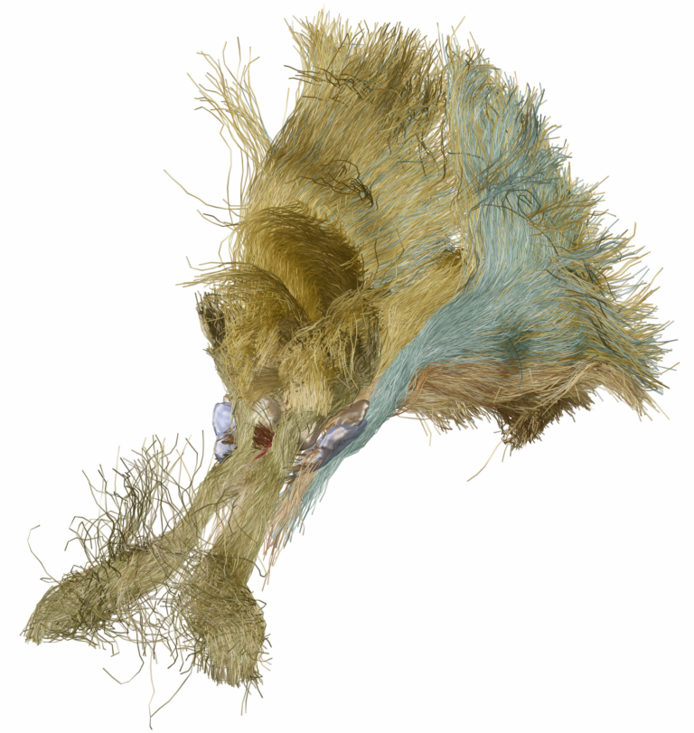 Subcortical Atlases (MNI-Space) – Lead-DBS