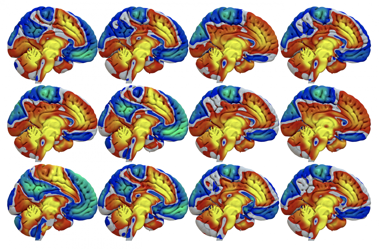 DBS Network Mapping – Lead-DBS