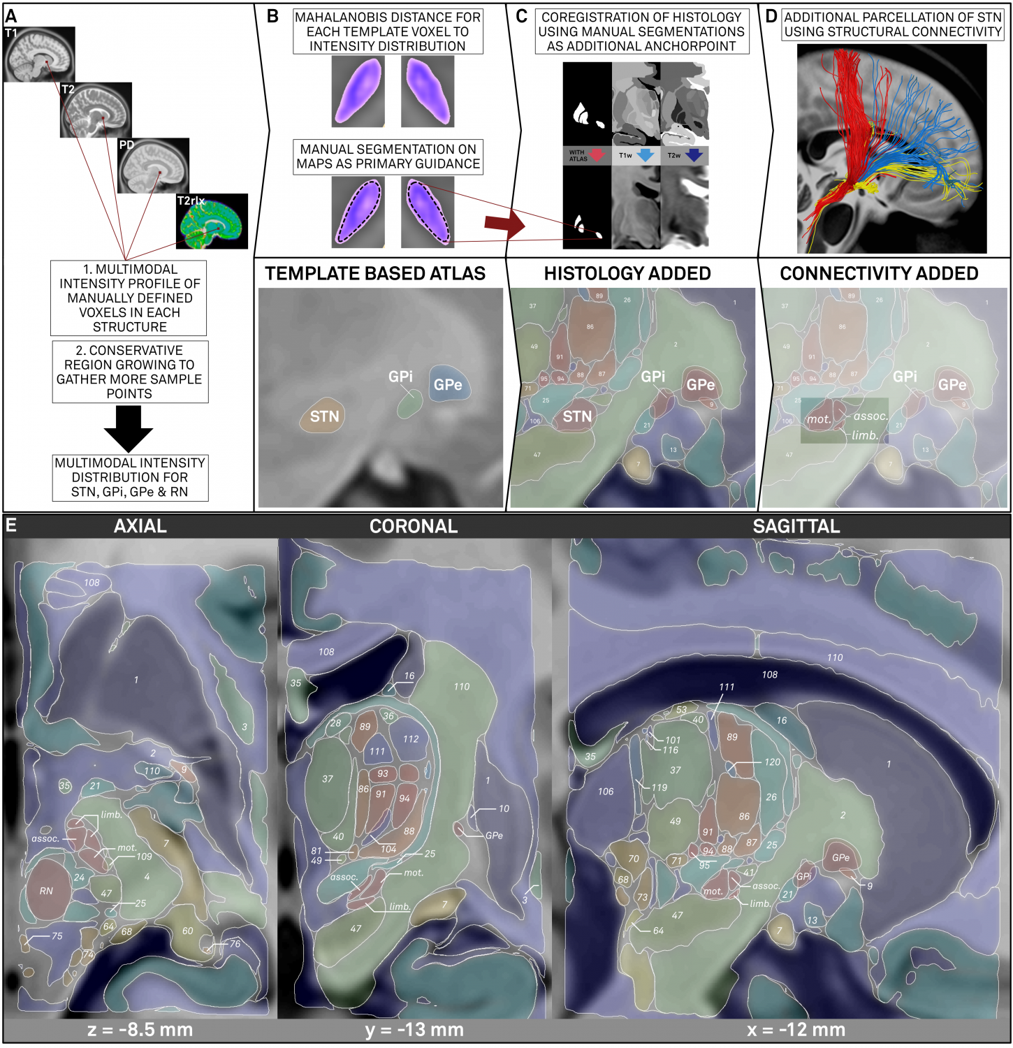 The DISTAL atlas – Lead-DBS