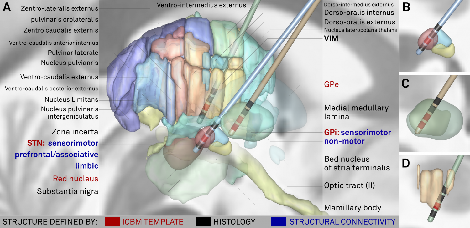 The DISTAL atlas – Lead-DBS