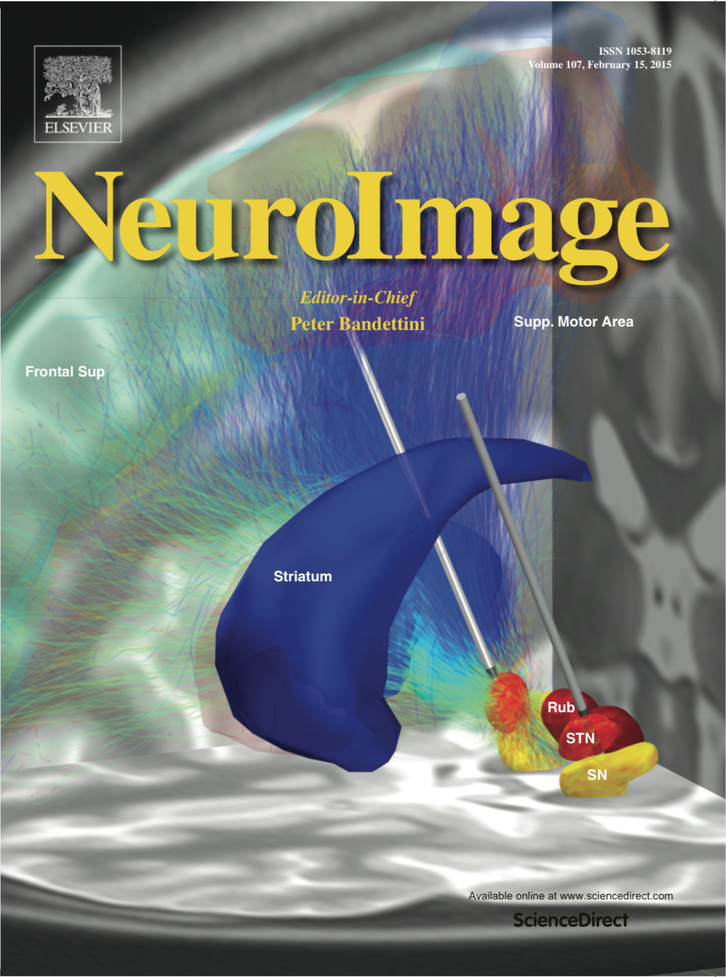 LEAD-DBS rendering selected for coverart in NeuroImage – Lead-DBS