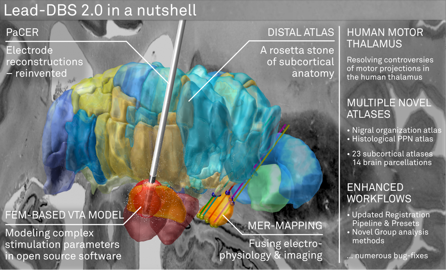 Lead-DBS v2.0 is out now! – Lead-DBS