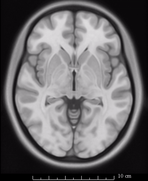 About the MNI space(s) – Lead-DBS