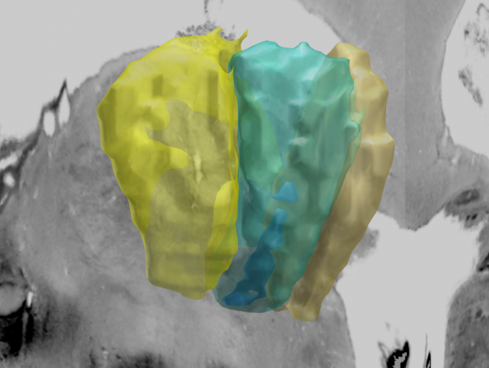 Subcortical Atlases (MNI-Space) – Lead-DBS