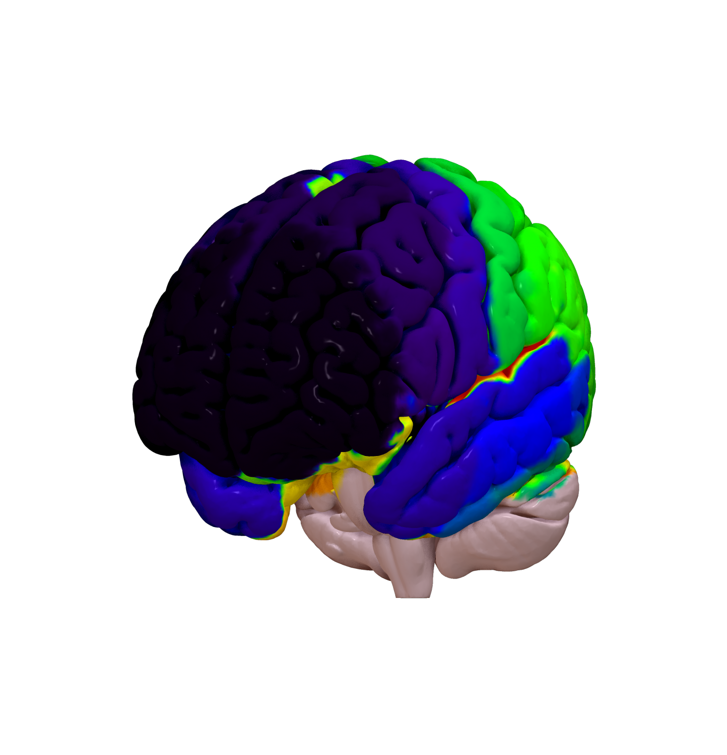 Cortical Atlas Parcellations Mni Space Lead Dbs