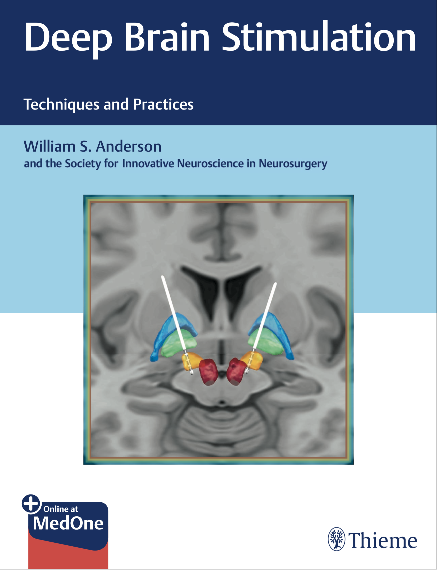 Publications – Lead-DBS